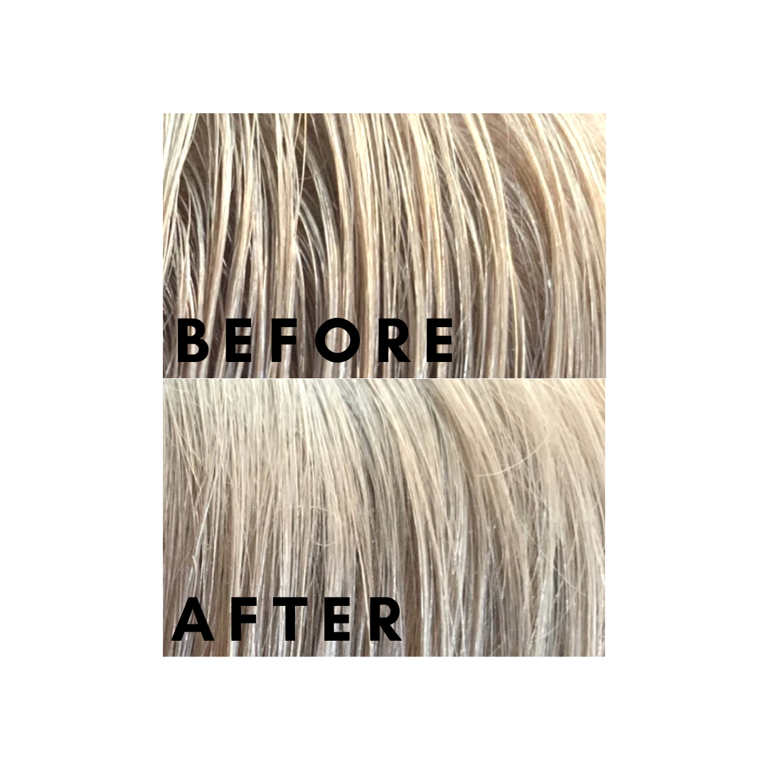 Scalpfix™ – Carter + Jane