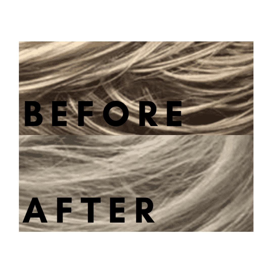 Scalpfix™ – Carter + Jane